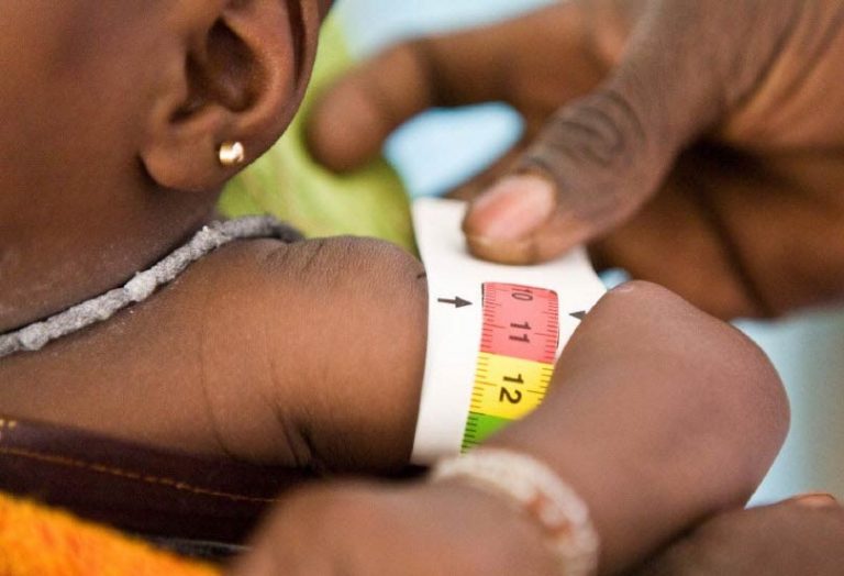 Desnutrição - O que é Causas, Sintomas e Tratamentos. | Cura Natural