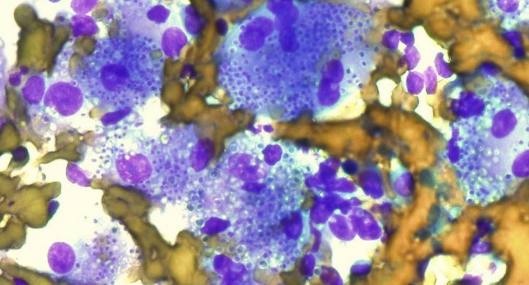 Histoplasmose - O que é, Causas e Tratamentos | Cura Natural